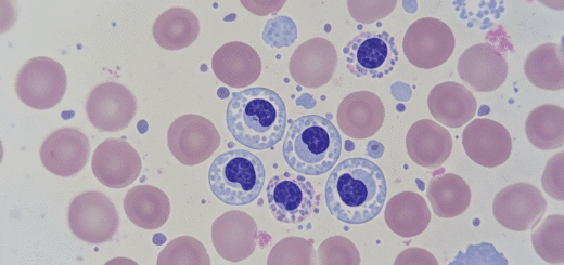 Anteja tyrimai: sveikatos diagnostikos revoliucija Lietuvoje - Sveikata ...